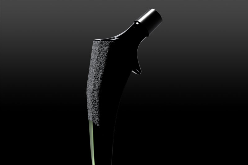 Products – Signature Orthopaedics