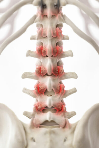 Patient Information – Spine – Signature Orthopaedics