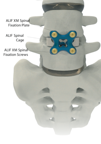Patient Information – Spine – Signature Orthopaedics