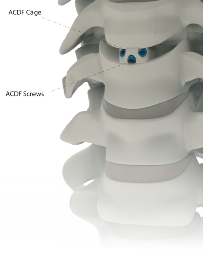 Patient Information – Spine – Signature Orthopaedics